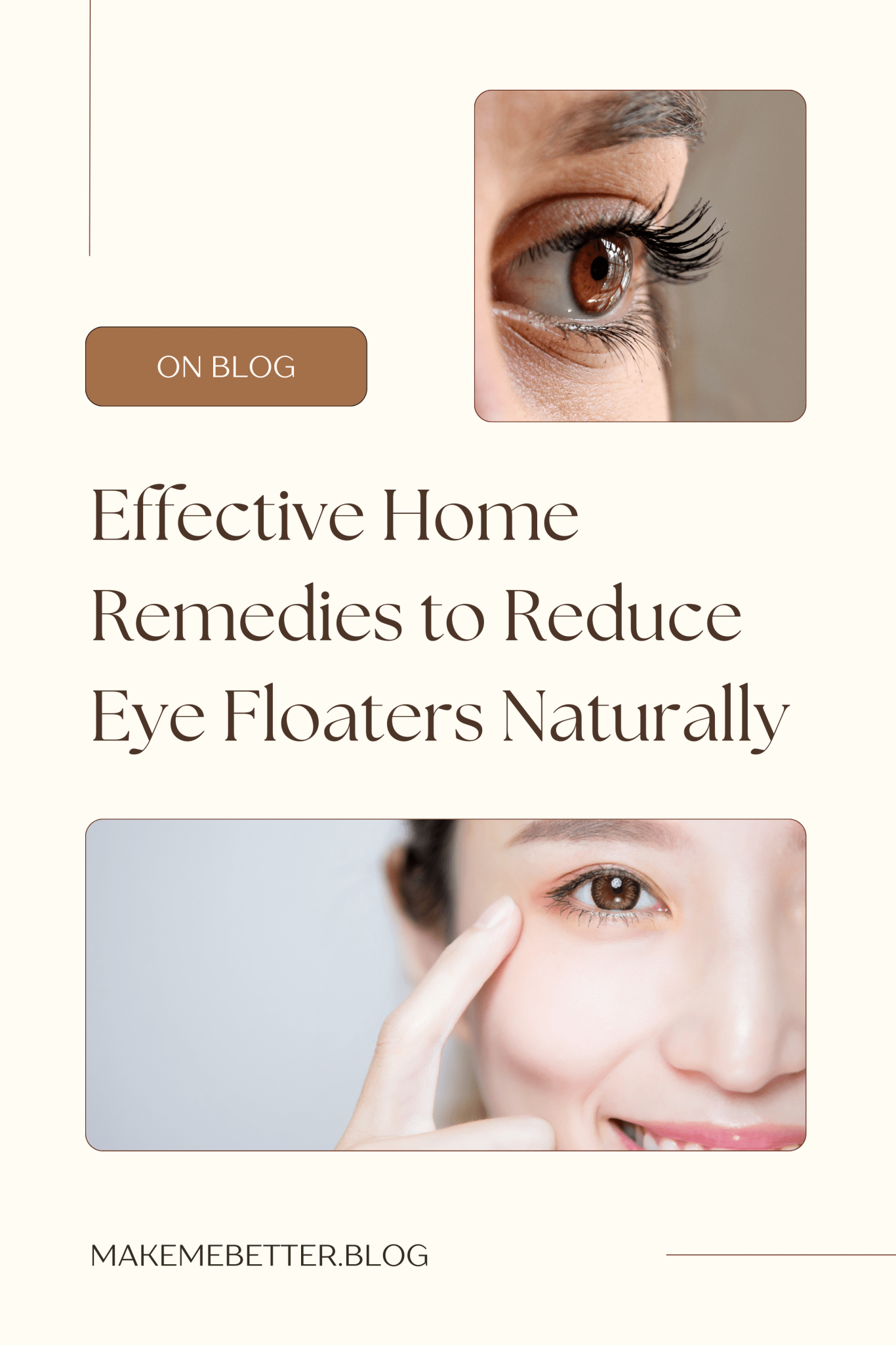 Effective Home Remedies for Eye Floaters: Natural Ways to Improve Your ...