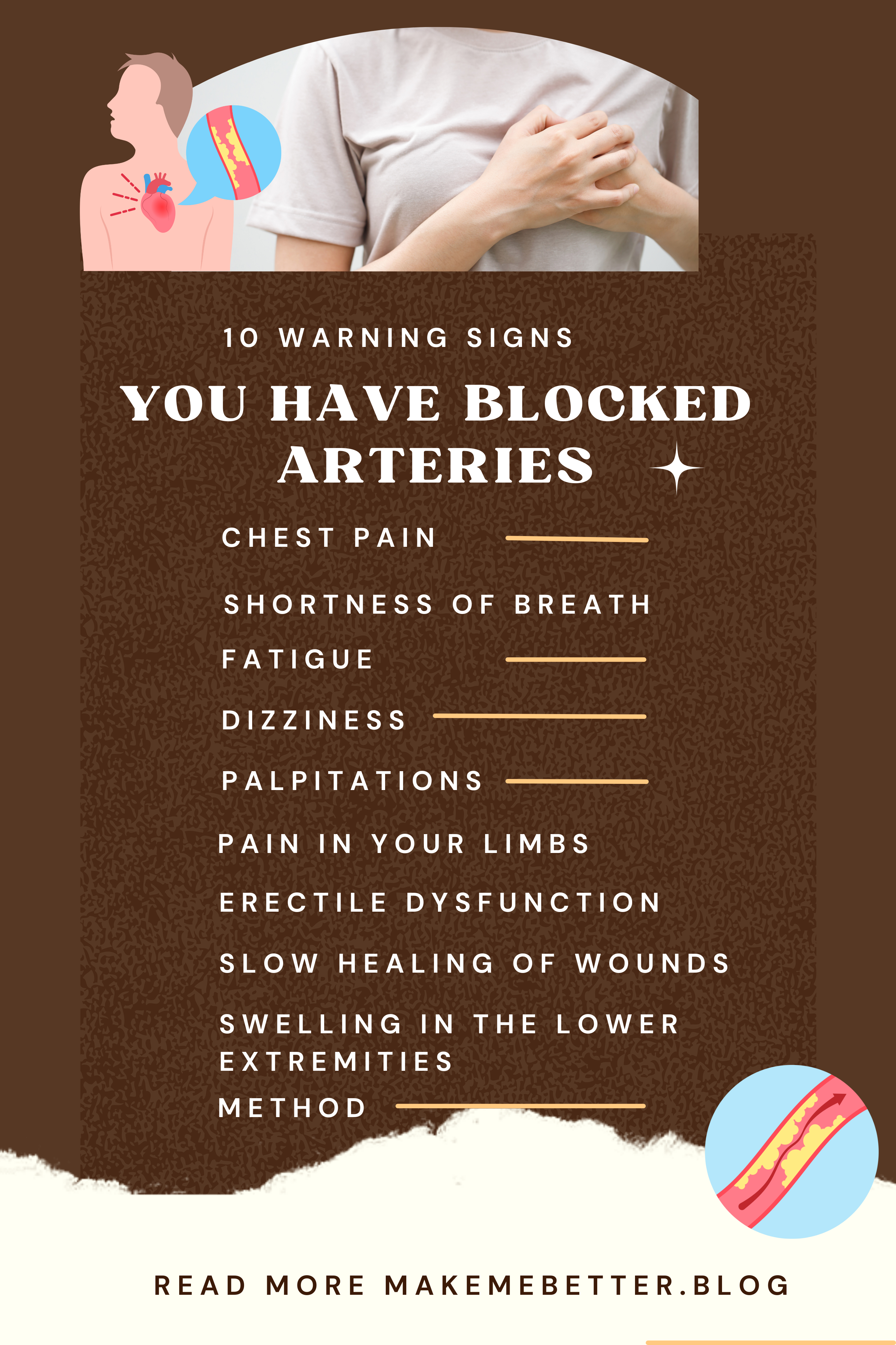 10 Warning Signs You Have Blocked Arteries and How to Prevent It – Make ...